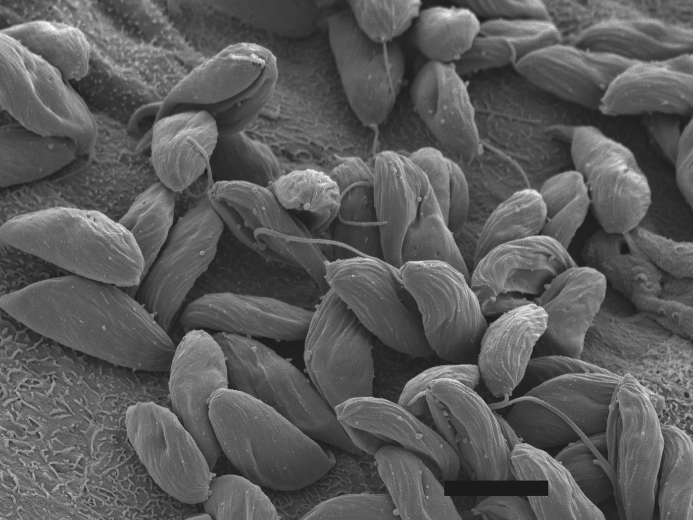 Impact and control of protozoan parasites in maricultured fishes ...