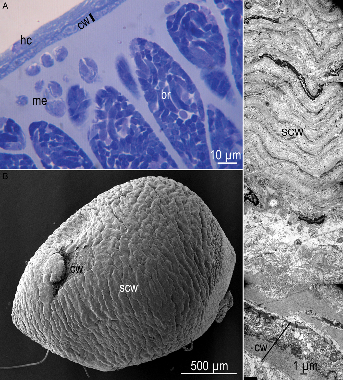 Sarcocystis masoni, n. sp. (Apicomplexa: Sarcocystidae), and ...