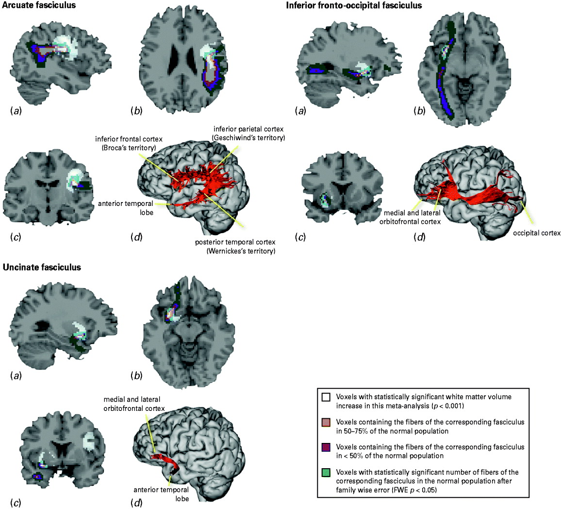 Voxel-based meta-analysis of regional white-matter volume differences ...