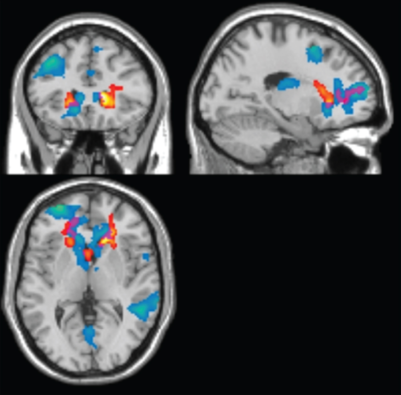‘Reading the Mind in the Eyes’: an fMRI study of adolescents with ...