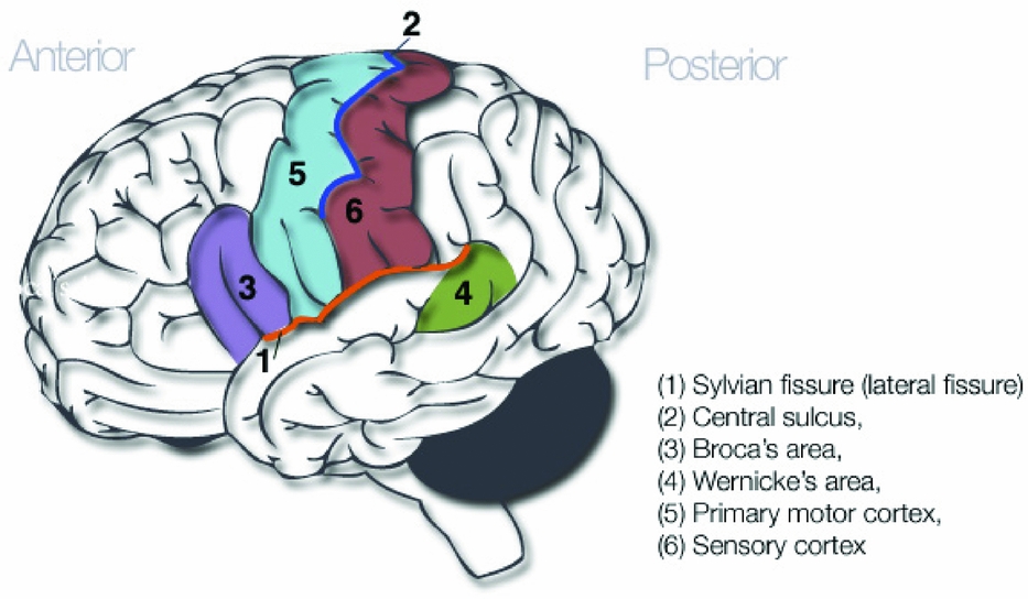 Cerebral Asymmetry: A Quantitative, Multifactorial, and Plastic Brain ...