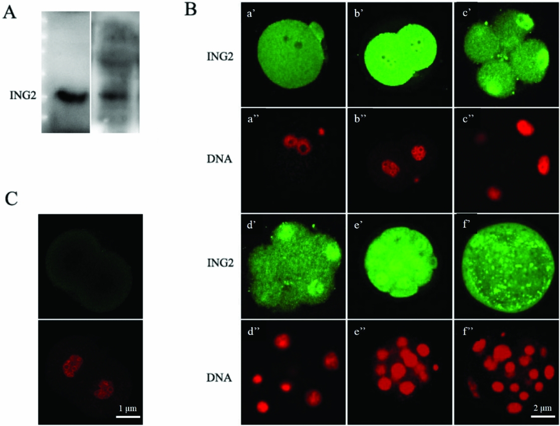 ING2 (inhibitor of growth protein-2) plays a crucial role in ...