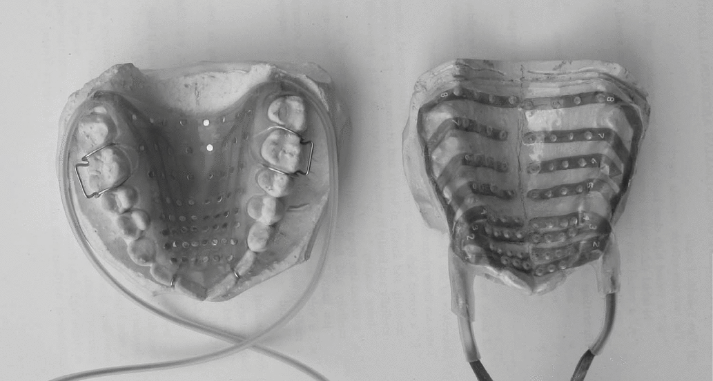 Electropalatography data from Central Arrernte: A comparison of the new ...