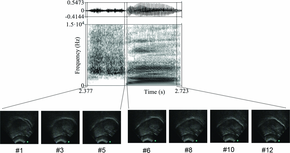 Revisiting Mandarin ‘apical vowels’: An articulatory and acoustic study ...