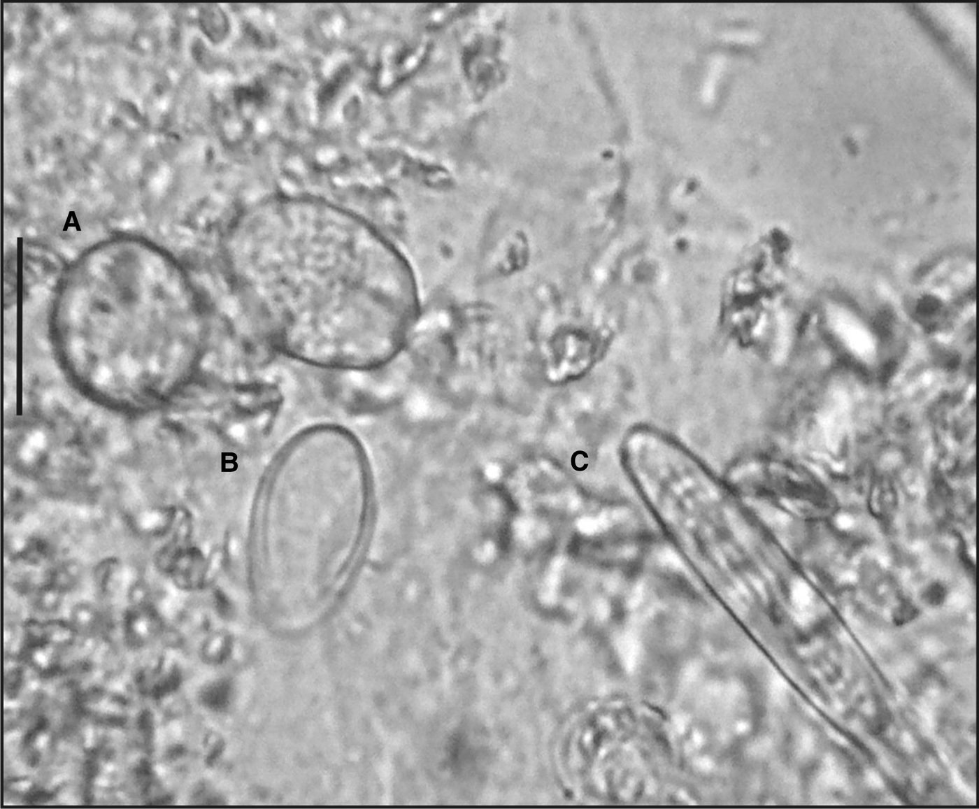 The parasite Monascus filiformis (Trematoda, Digenea, Fellodistomidae ...