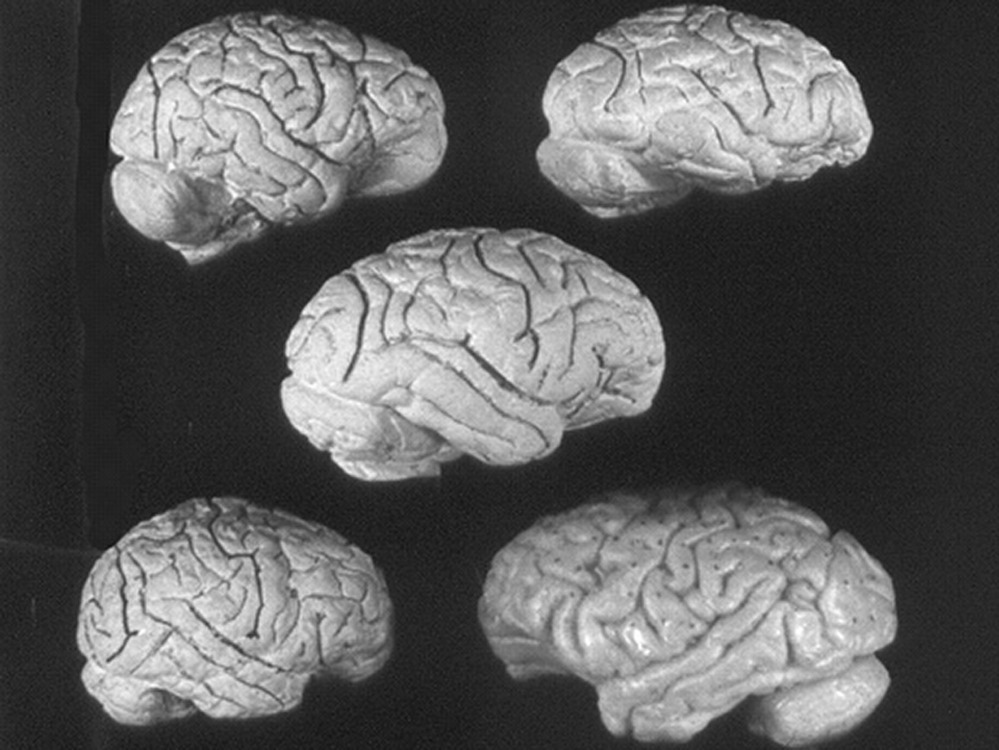 Visualising And Interpreting The Brain Of Australopithecus