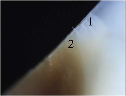 Zinc-Containing Restorations Create Amorphous Biogenic Apatite at the ...