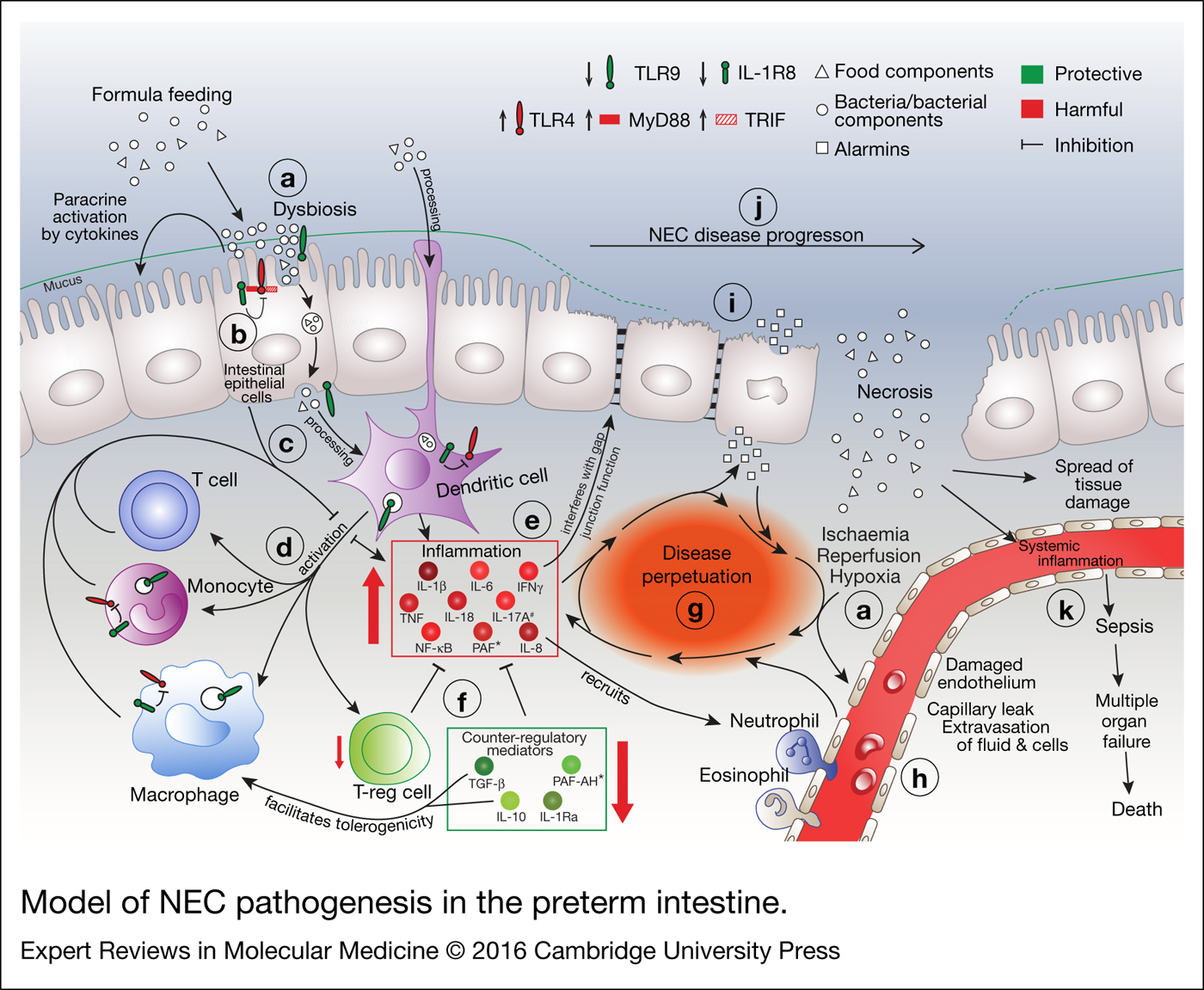 The immunological landscape in necrotising enterocolitis | Expert ...