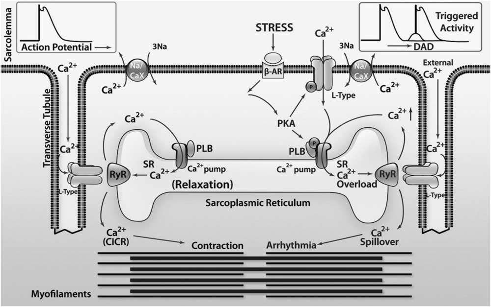 Advances in the diagnosis and treatment of catecholaminergic ...