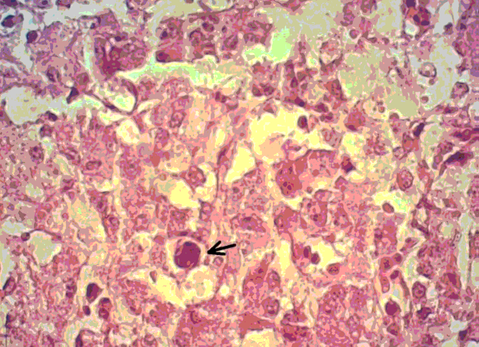 Viral hepatitis in chicken and turkeys | World's Poultry Science ...