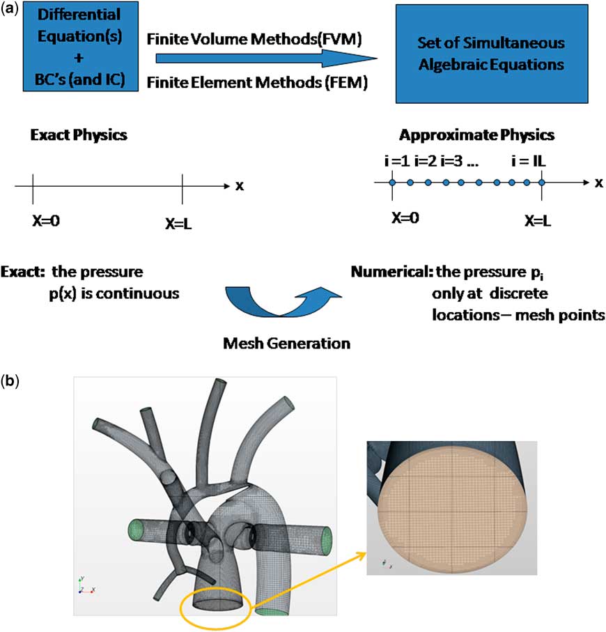 Computational fluid dynamics in congenital heart disease* | Cardiology ...