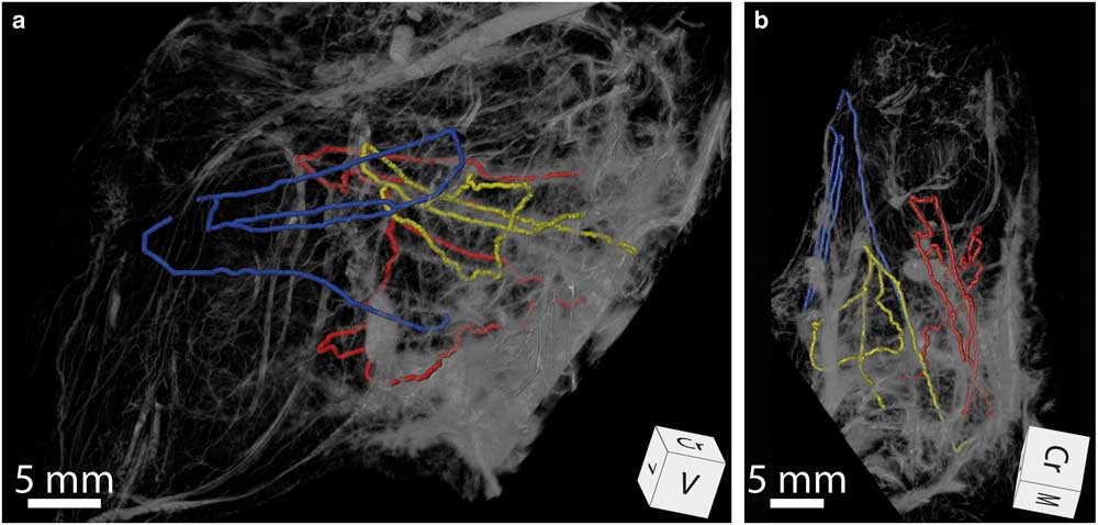 Optimization of Vascular Casting for Three-Dimensional Fluorescence ...