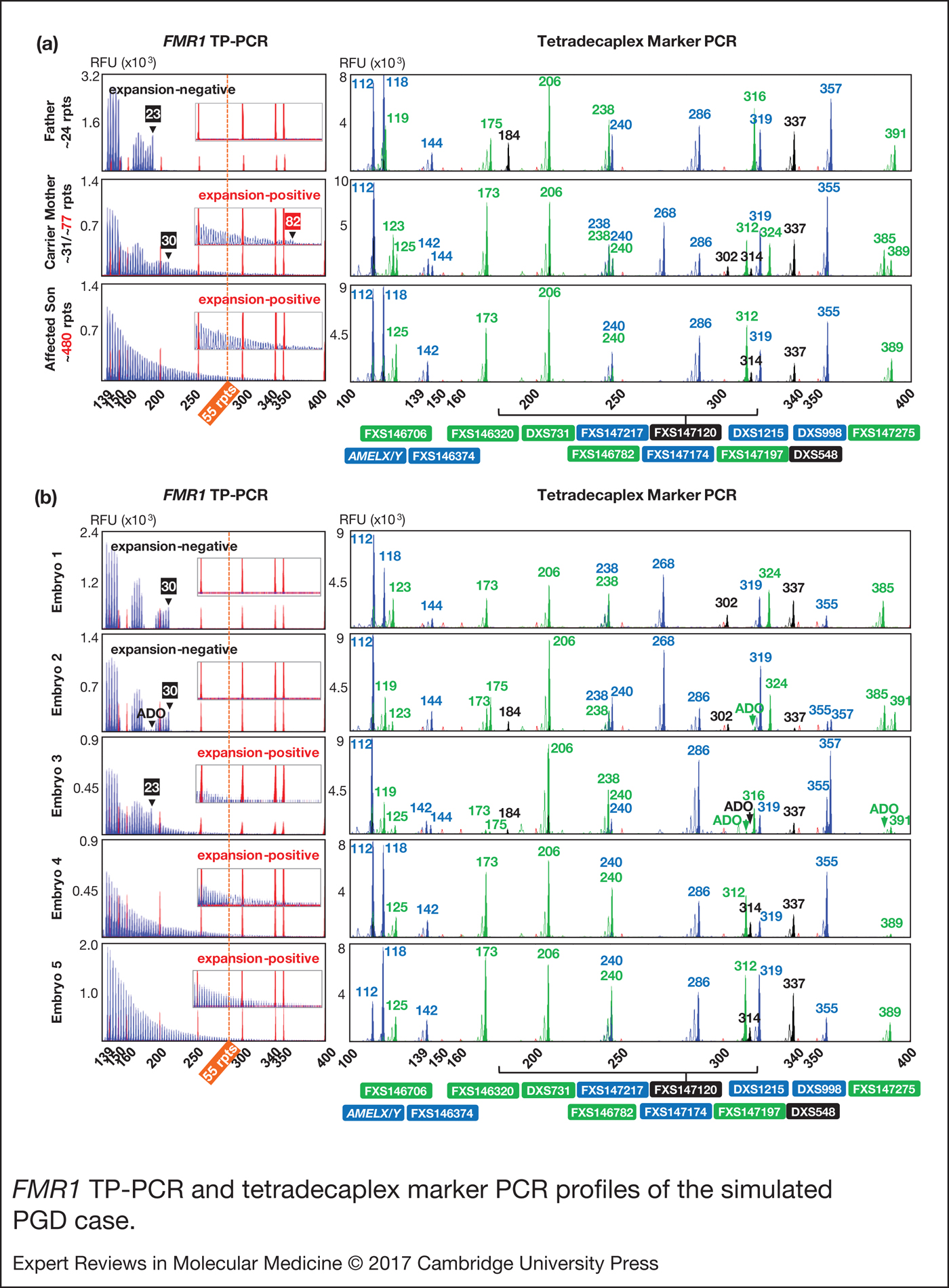 FMR1 CGG repeat expansion mutation detection and linked haplotype ...