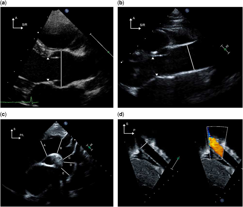 Assessment of the structure and function of the aorta by ...