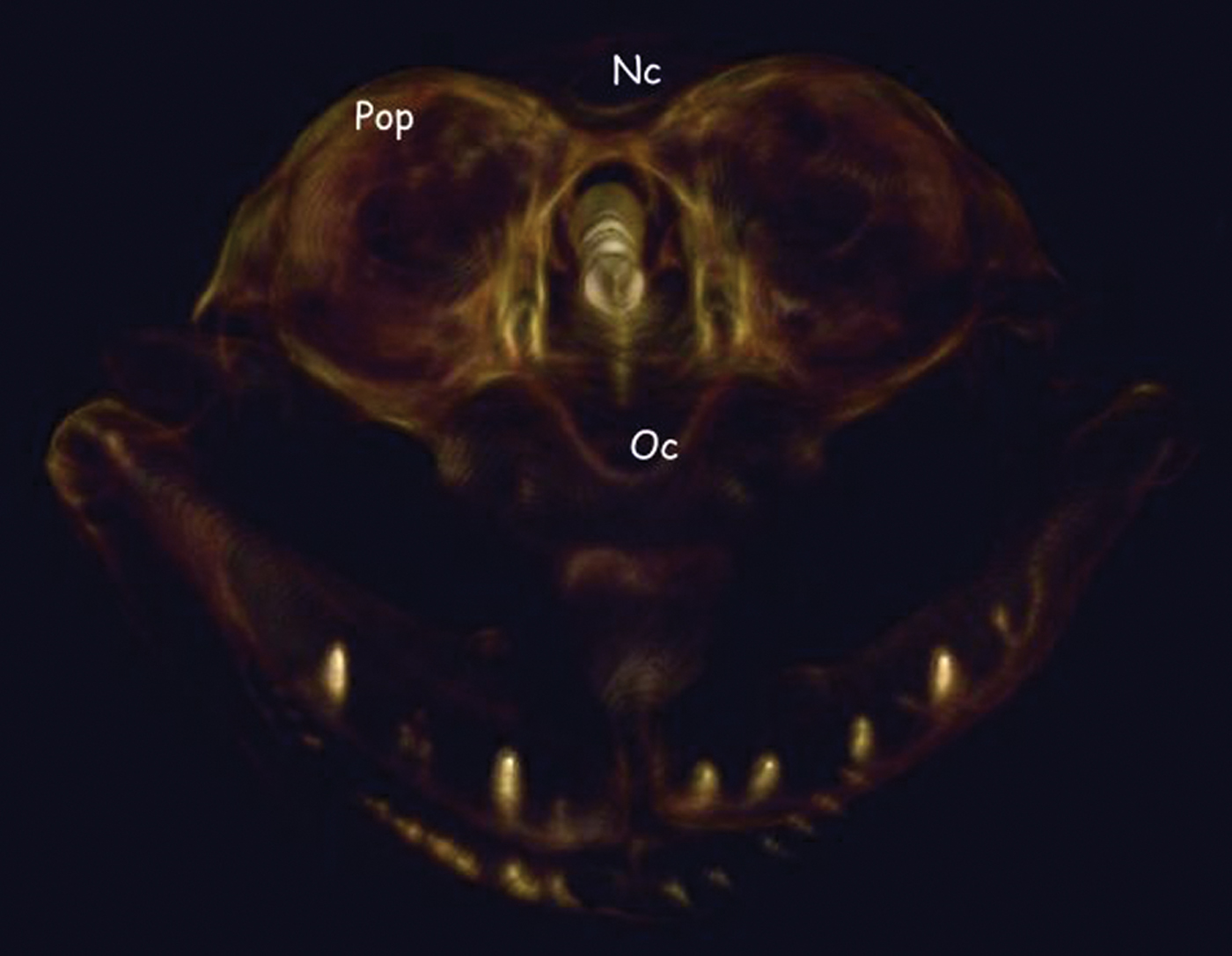 First report of an embryonic dusky shark (Carcharhinus obscurus) with ...