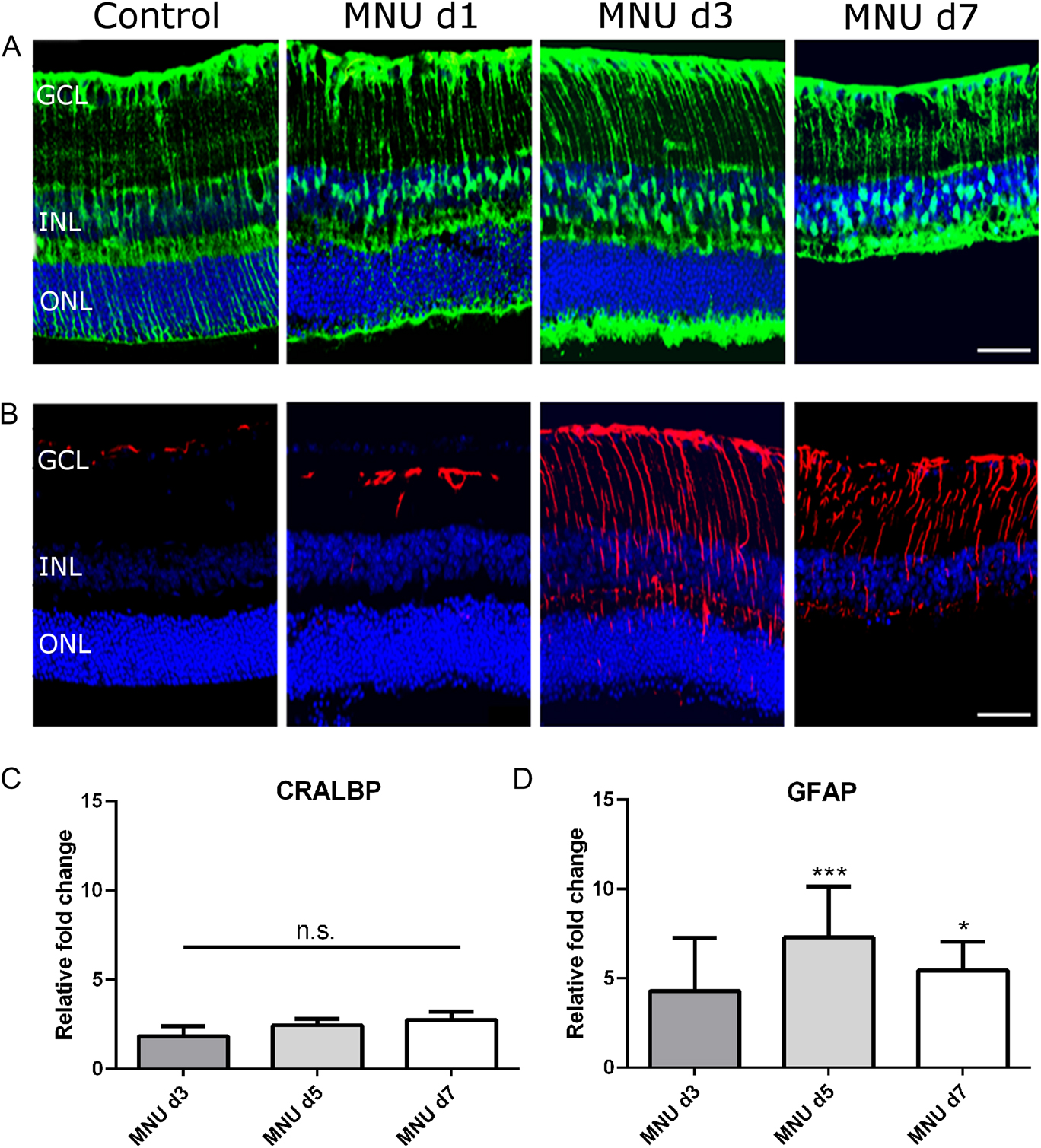 Characteristics of Müller glial cells in MNU-induced retinal ...