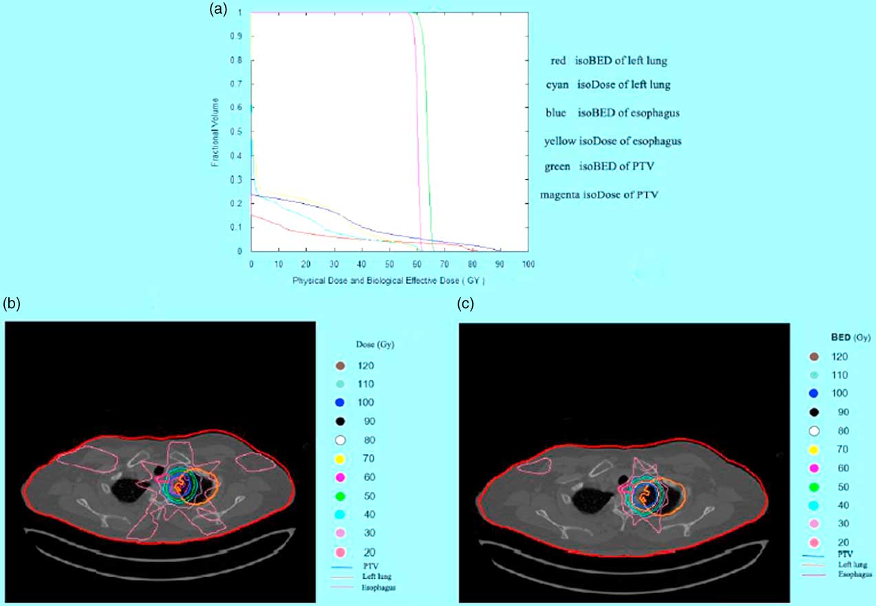 Development of 3D biological effective dose distribution software ...