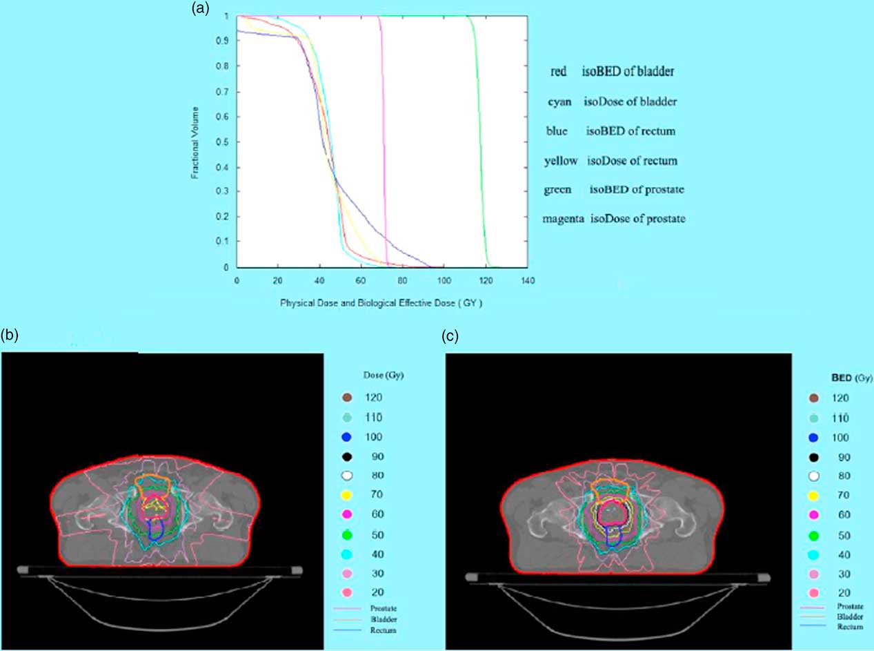 Development of 3D biological effective dose distribution software ...