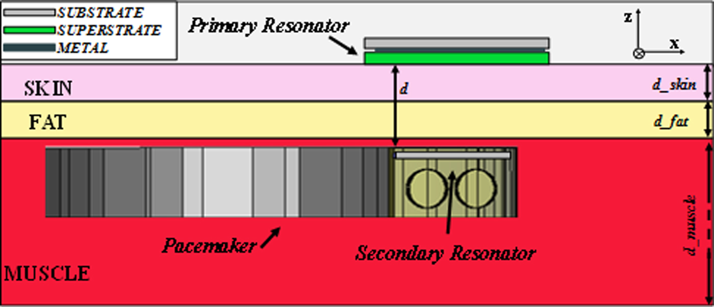 Inductive link for power and data transfer to a medical implant ...