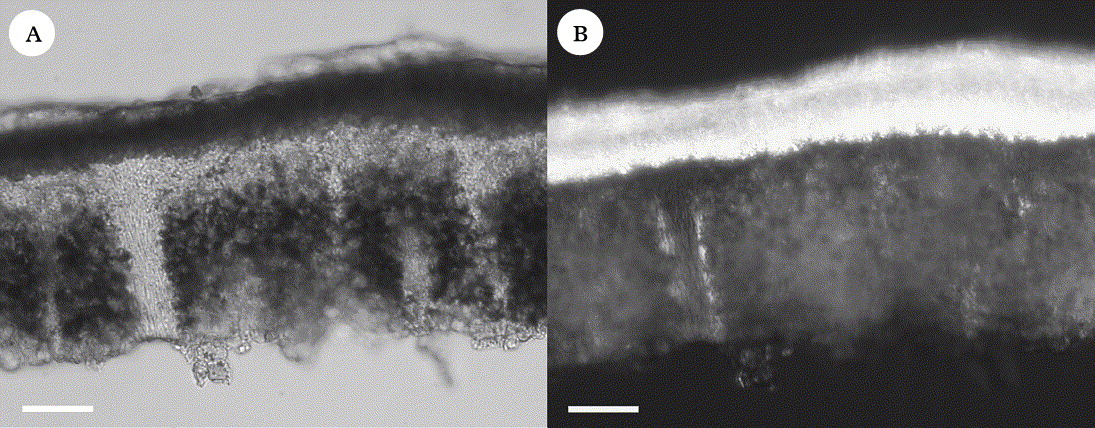 Silobia, a new genus for the Acarospora smaragdula complex (Ascomycota ...