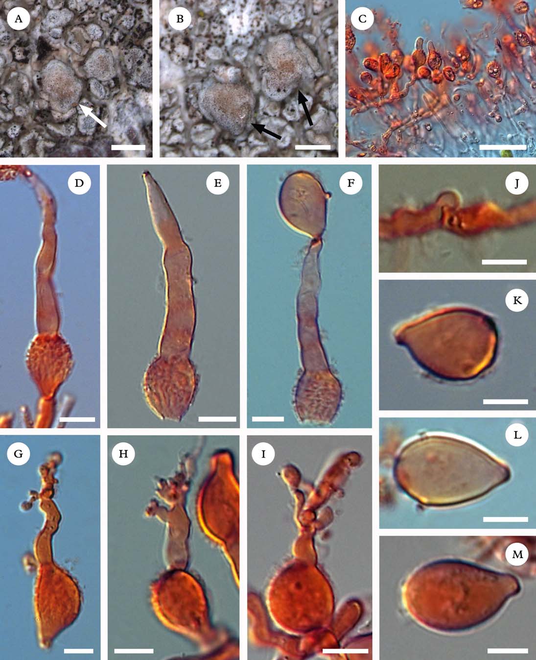 Heteroacanthella ellipsospora sp. nov., the first lichenicolous ...