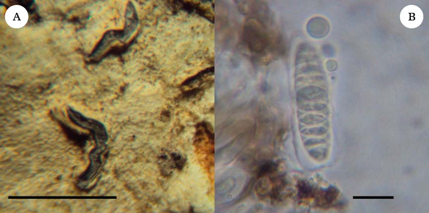 Three new Diorygma (Graphidaceae) species from Brazil, with a revised ...