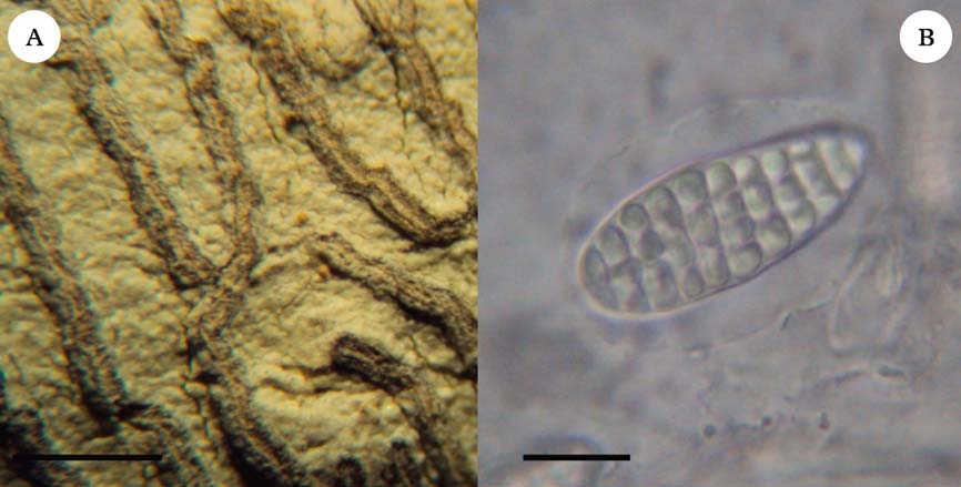 Three new Diorygma (Graphidaceae) species from Brazil, with a revised ...