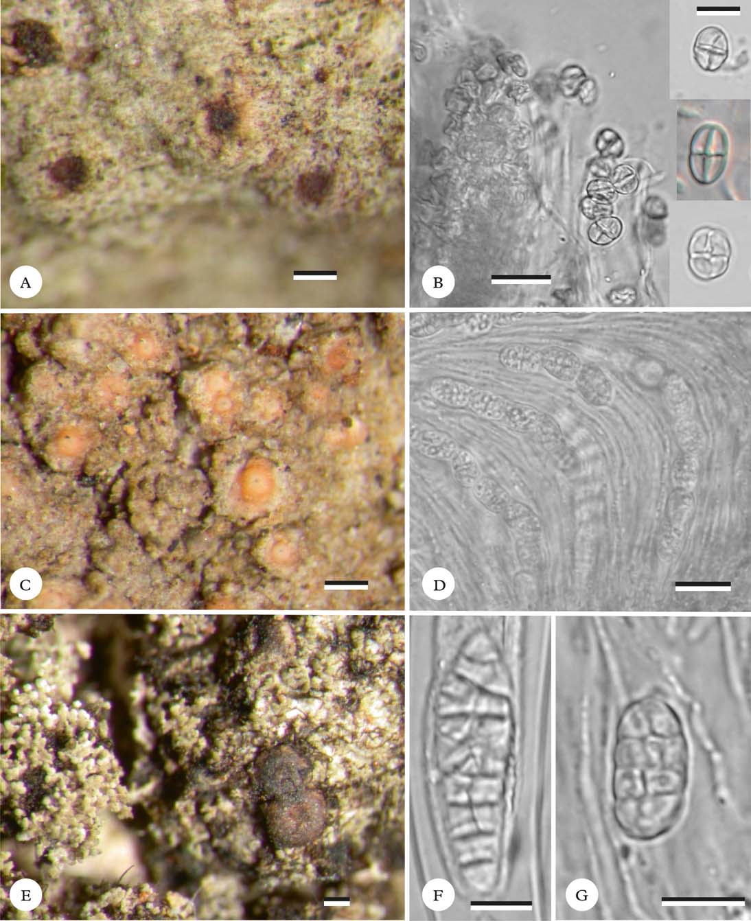 A world key to species of the genera Topelia and Thelopsis ...