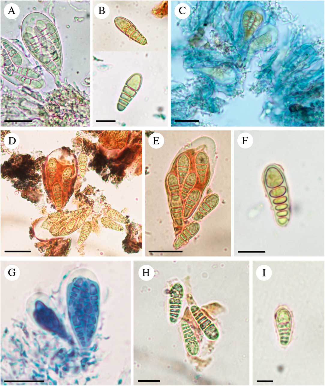 Contributions to the genus Synarthonia (lichenized Ascomycota ...