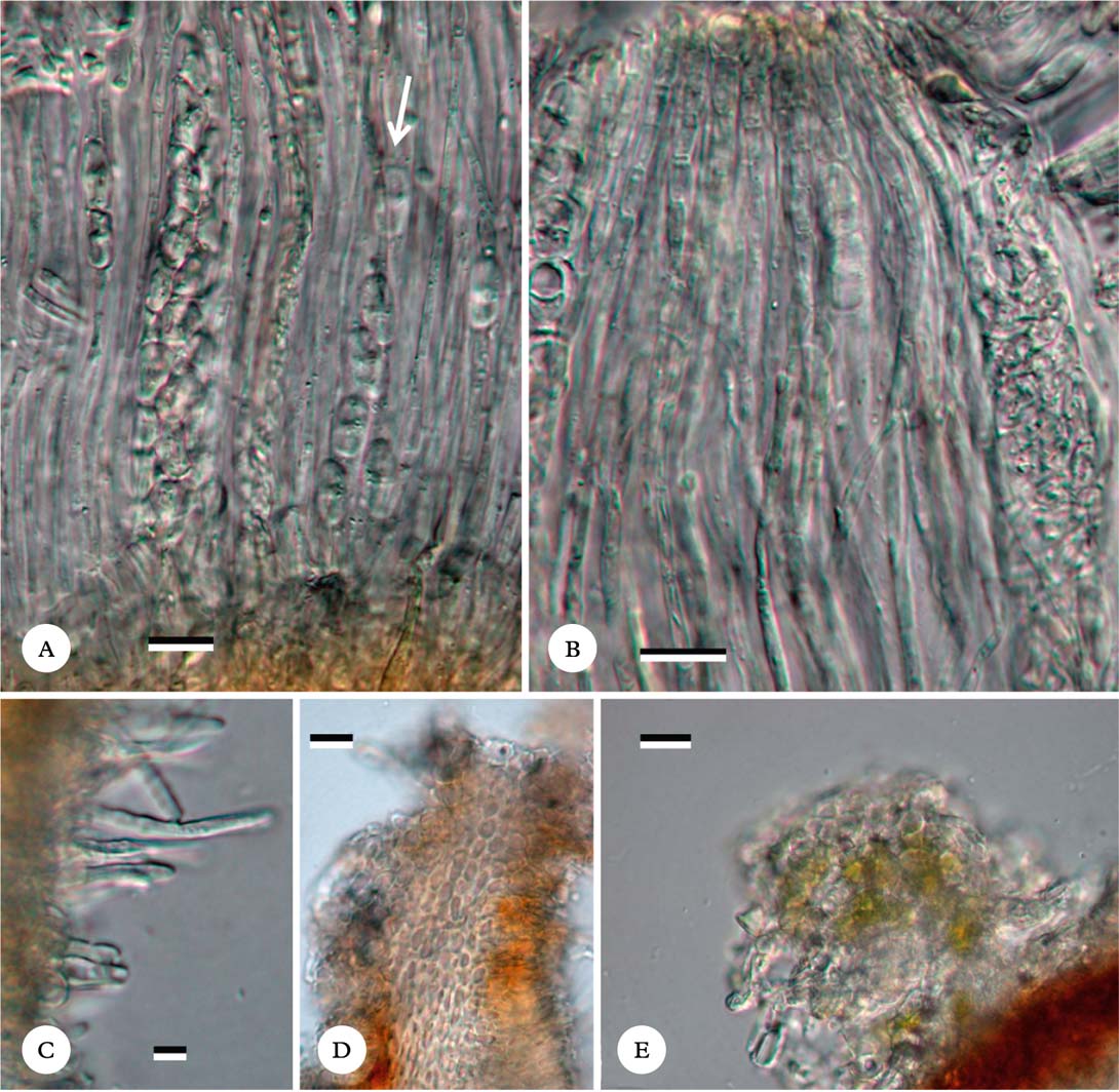 A remarkable new Ramonia (Gyalectaceae) from Brazil, with a key to the ...