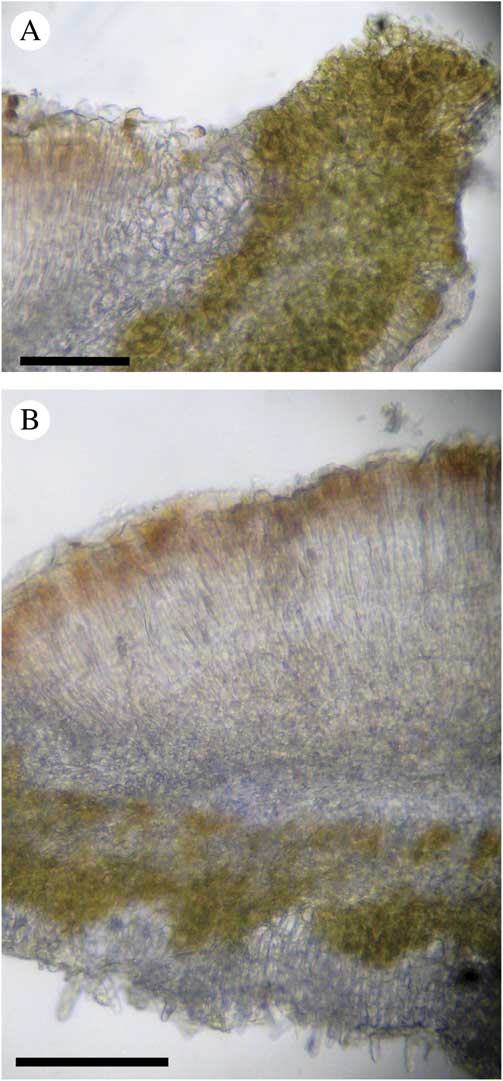 A revision of the Leptogium saturninum group in North America | The ...