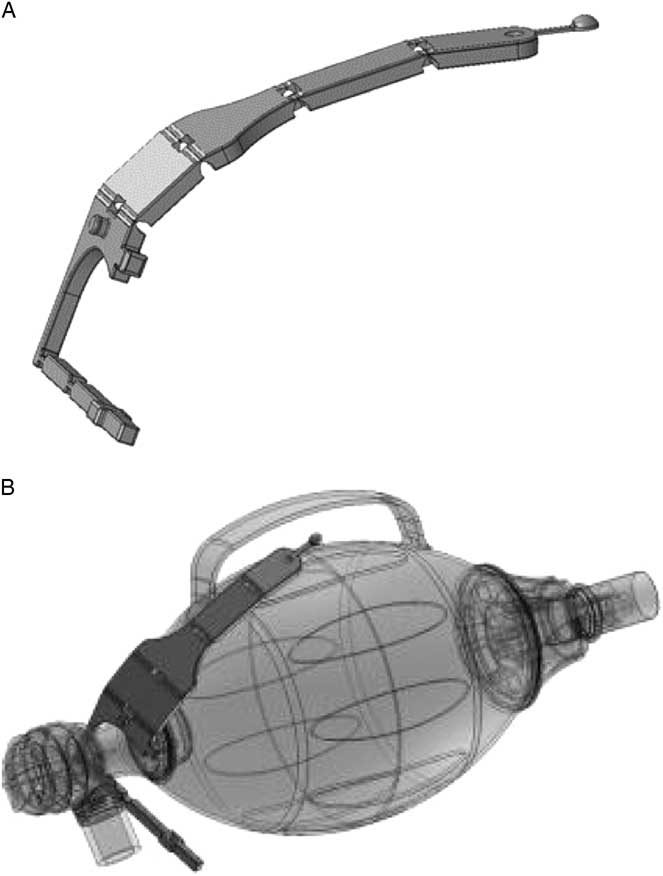 Single Rescuer Ventilation Using a Bag Valve Mask with Removable ...