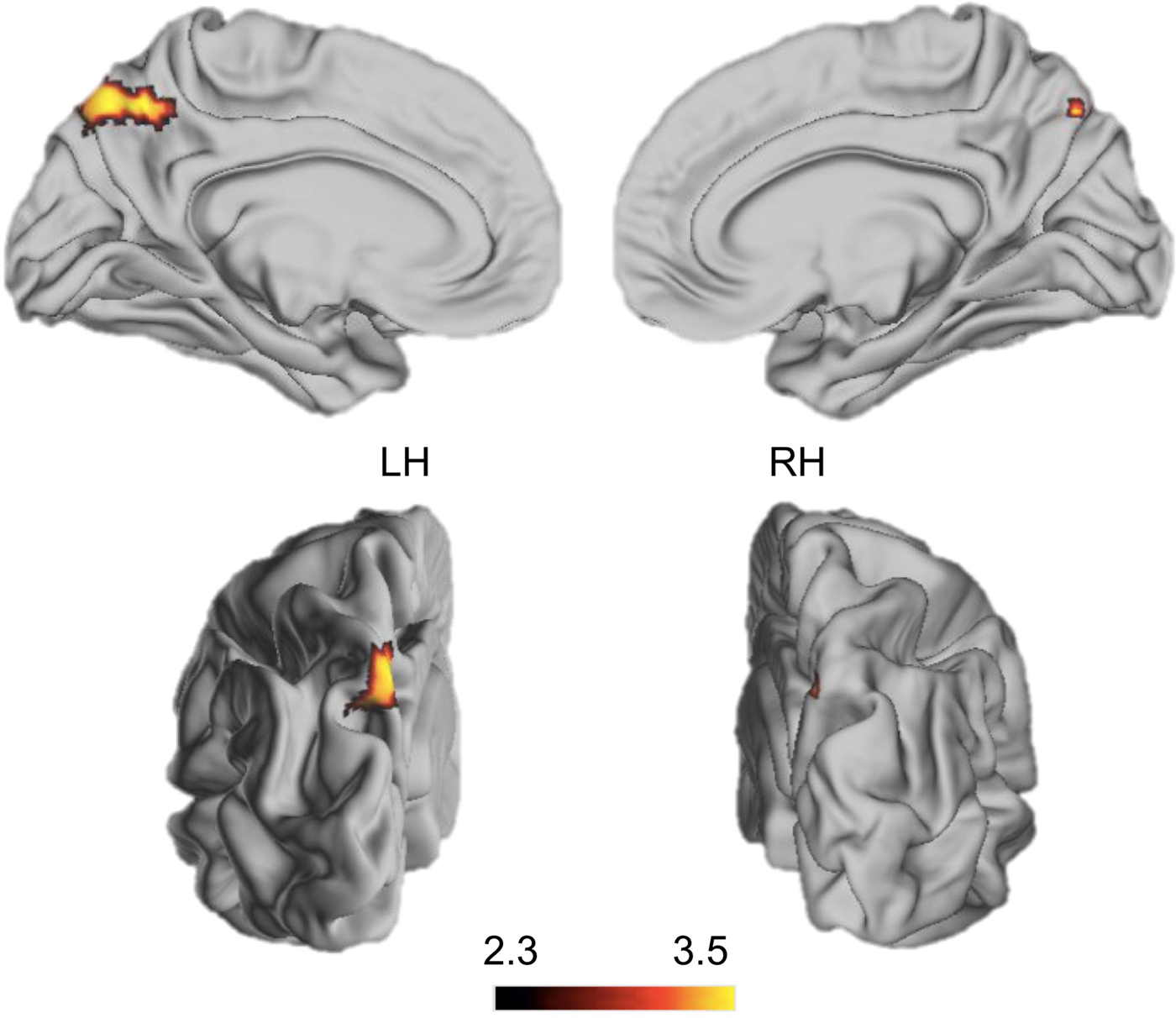 Dimensions of childhood adversity have distinct associations with ...
