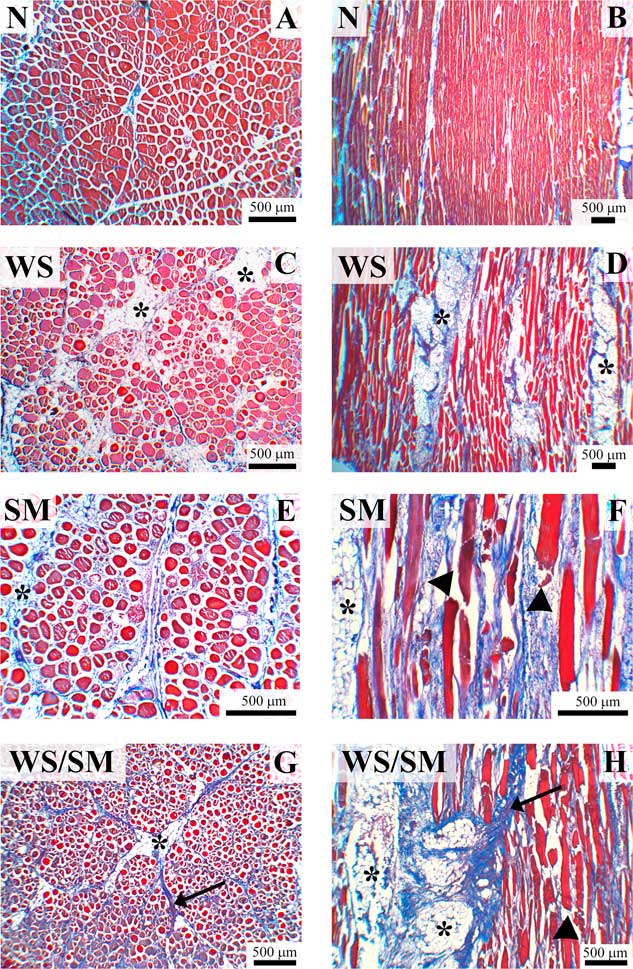 Implications of white striping and spaghetti meat abnormalities on meat ...