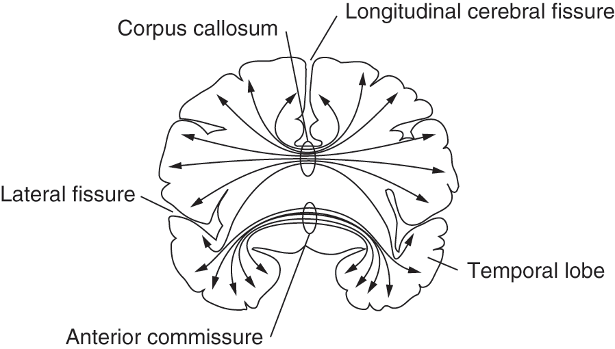 Posterior Commissure Coronal