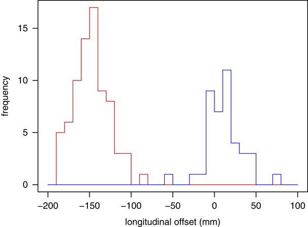 The impact of reference isocentre position on set-up errors in head-and ...
