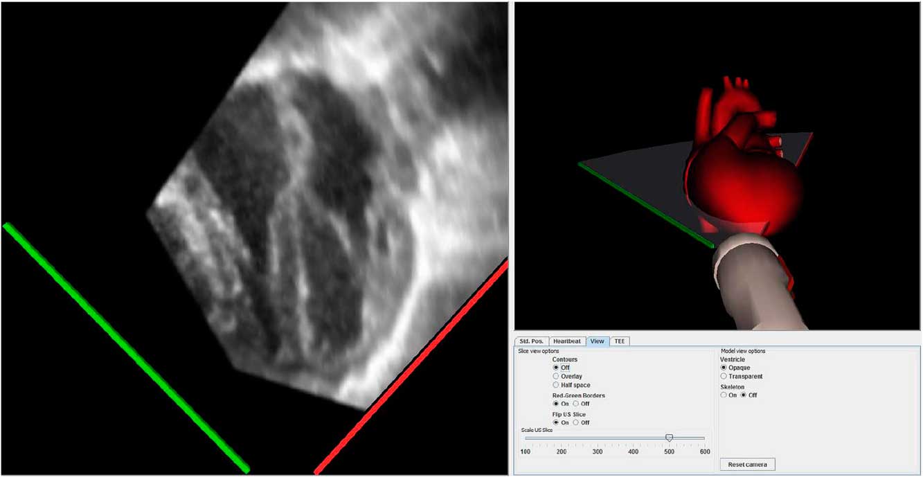 Effectiveness of echocardiography simulation training for paediatric ...