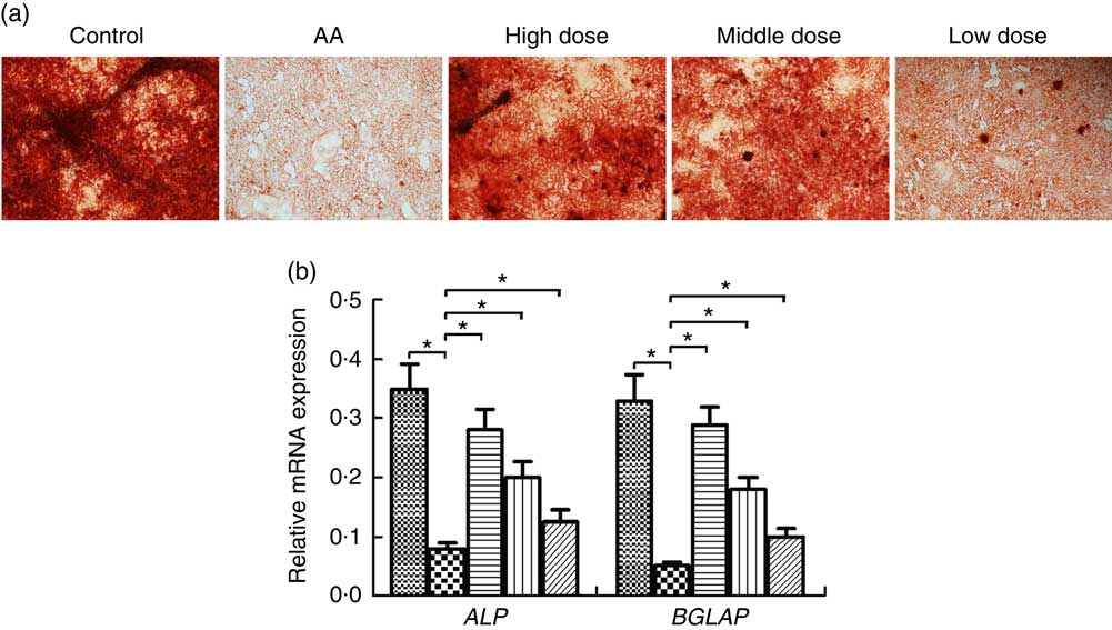 Effect Of Nutritional Supplement On Bone Marrow Derived Mesenchymal