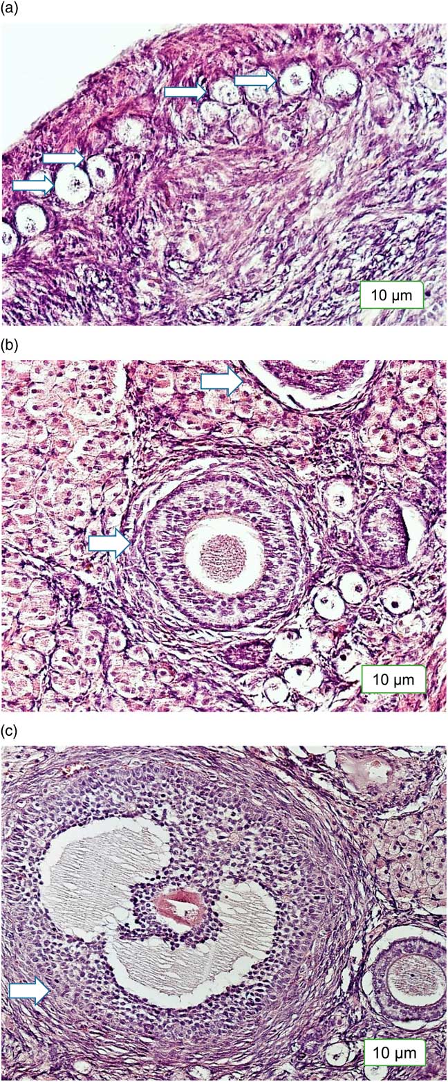Effect of turmeric on the viability, ovarian folliculogenesis ...