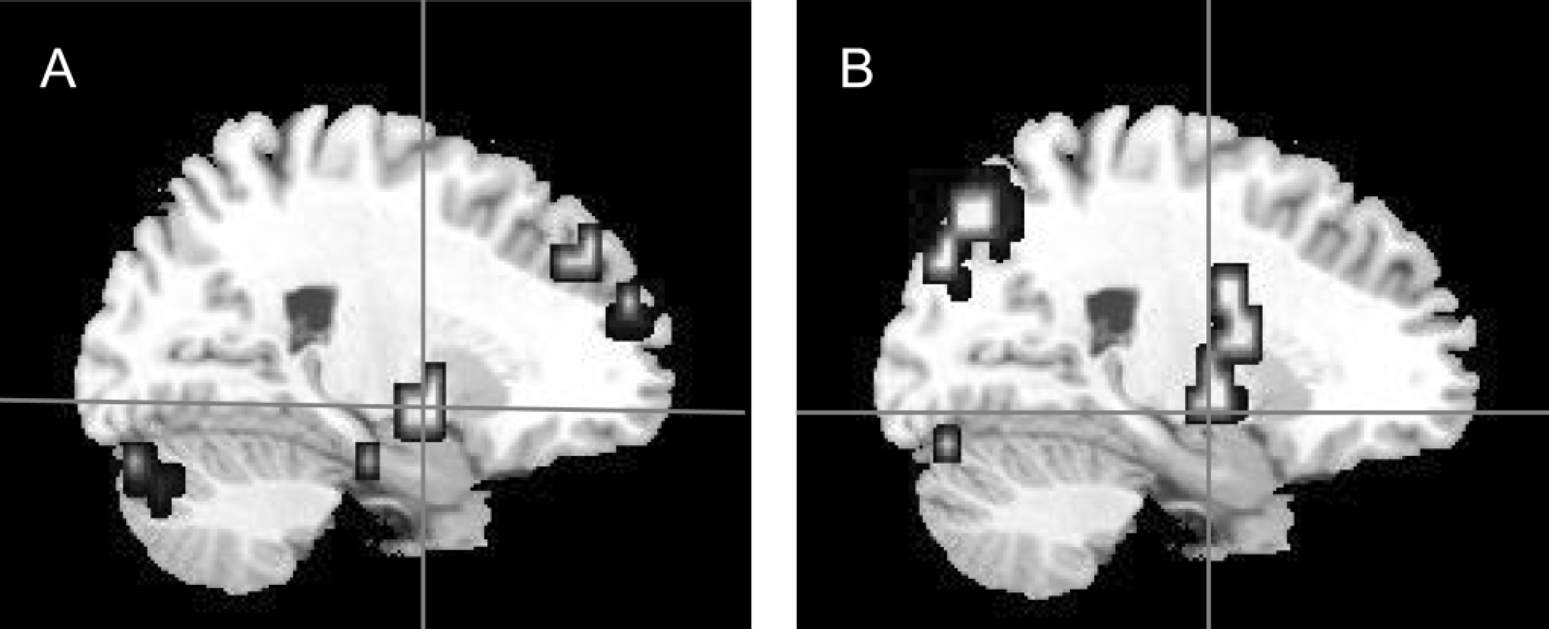 Facial fear processing and psychotic symptoms in schizophrenia ...