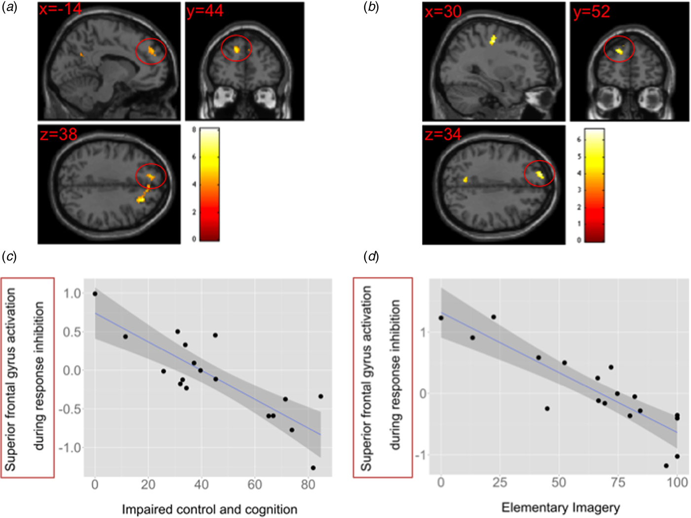 Acute LSD effects on response inhibition neural networks ...