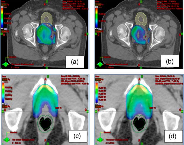 The experience of a developing country using an electronic portal ...