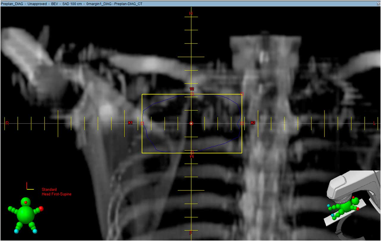 Pre-planning: a new approach to virtual simulation | Journal of ...