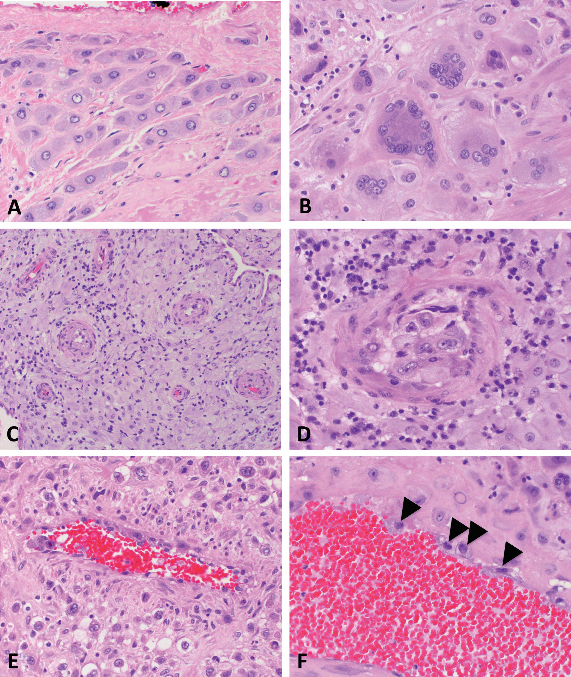 Chorionic Villi Histology Labeled