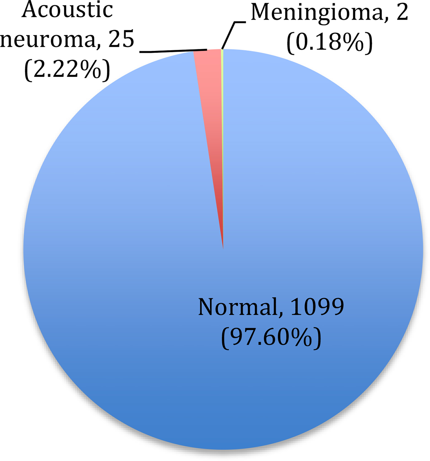 Audiologist-led screening of acoustic neuromas in patients with ...