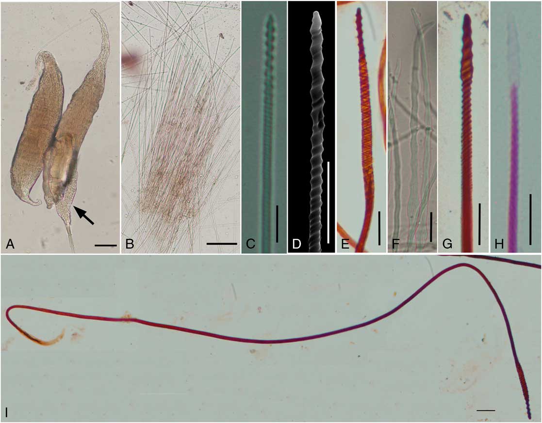 Morphology of testes, spermatogenesis, sperm bundles, and spermatozoa ...