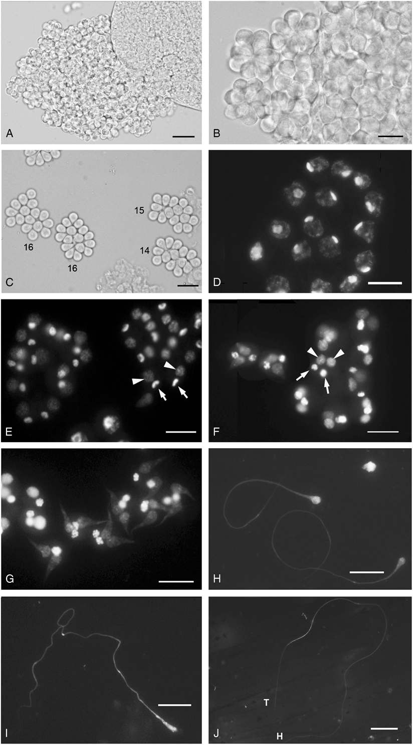 Morphology of testes, spermatogenesis, sperm bundles, and spermatozoa ...