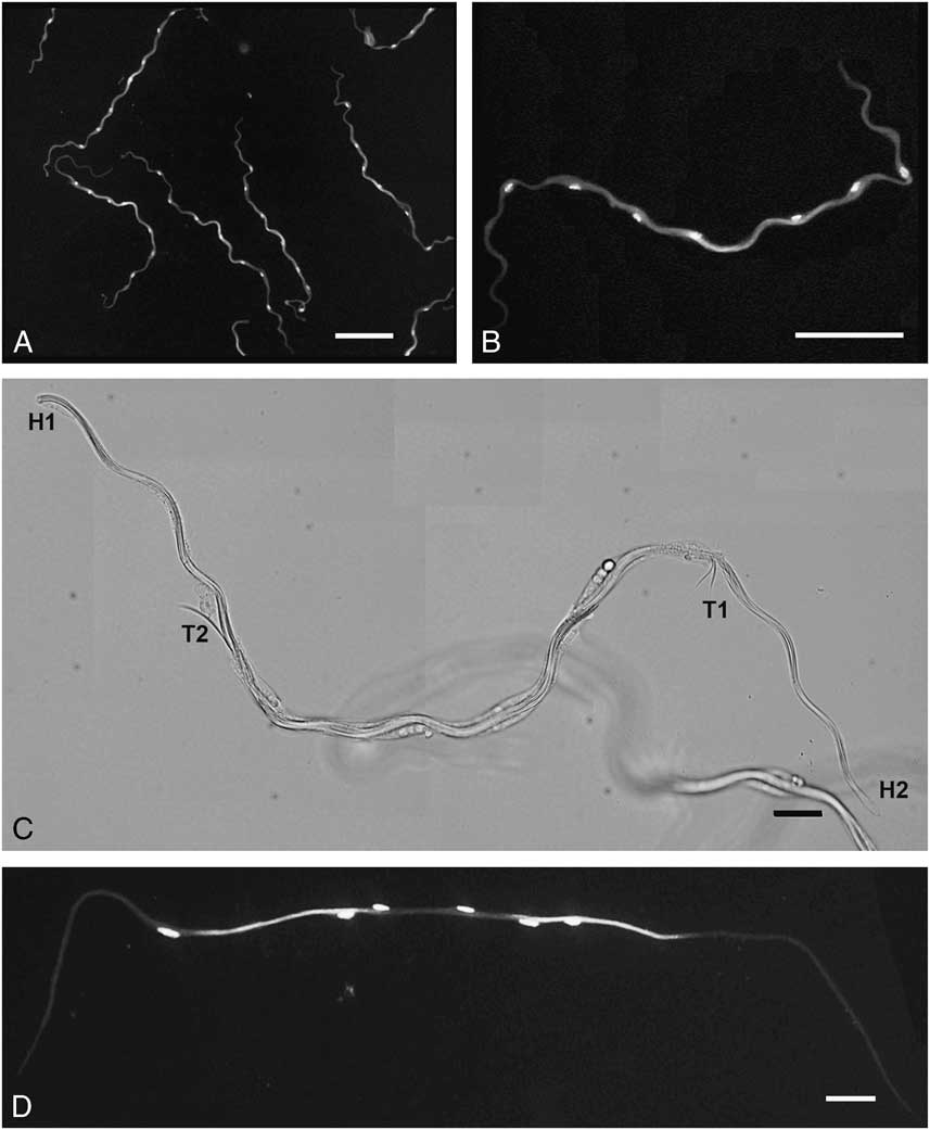 Morphology of testes, spermatogenesis, sperm bundles, and spermatozoa ...