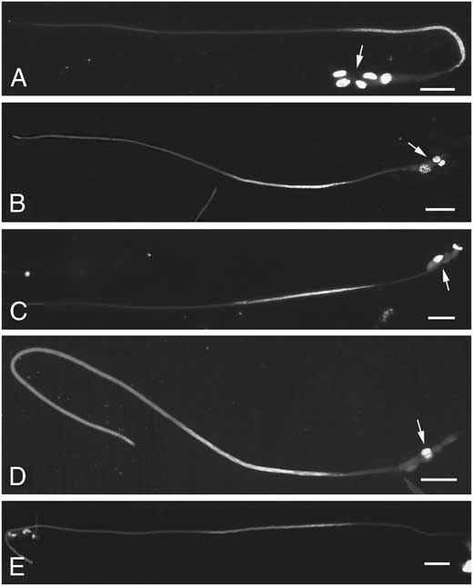 Morphology of testes, spermatogenesis, sperm bundles, and spermatozoa ...