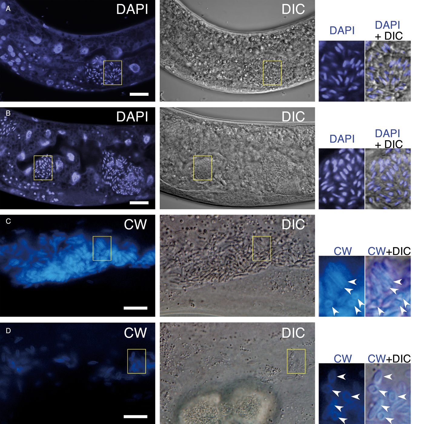 A new microsporidium Percutemincola moriokae gen. nov., sp. nov. from ...